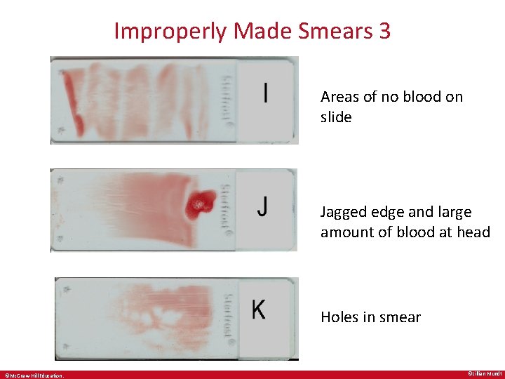 Special Phlebotomy Procedures Chapter 13 Mc GrawHill Education