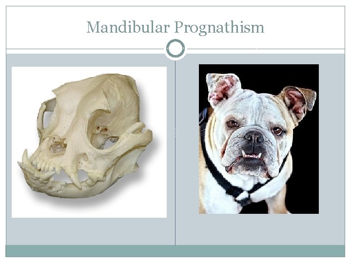 Malocclusion Malocclusion is an abnormality in the position