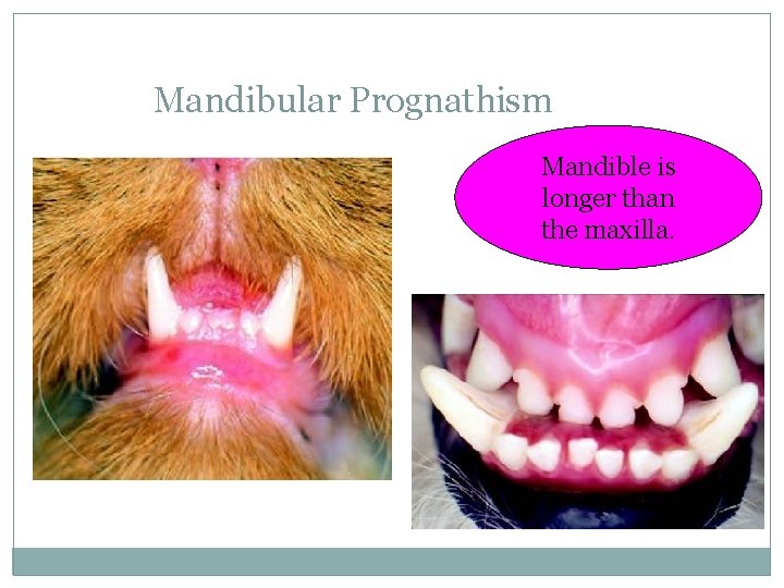 Malocclusion Malocclusion is an abnormality in the position