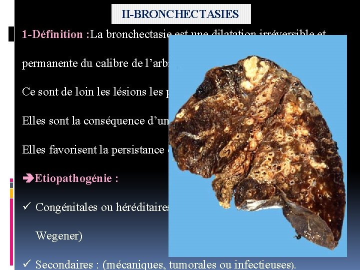 DYSTROPHIES BRONCHOPULMONAIRES Chapitre I DYSTROPHIES BRONCHIQUES ...