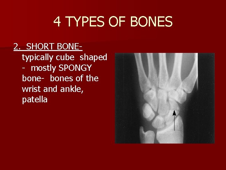 SKELETAL SYSTEM 206 BONES MAKE UP THE HUMAN