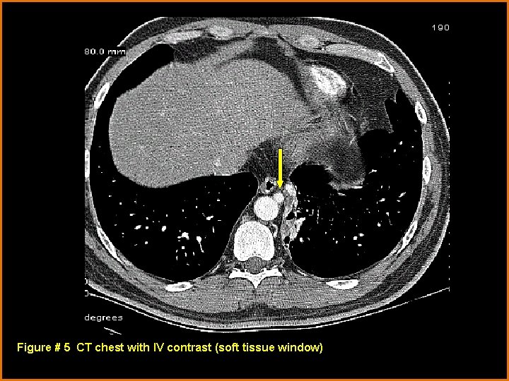 Radiological Category Thoracic Chest Principal Modality CT Case