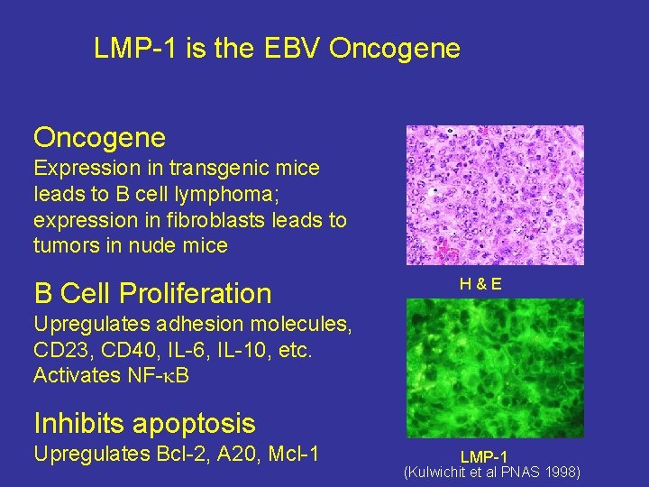 EpsteinBarr Virus Cancer and Immunosuppression Jeffrey I Cohen