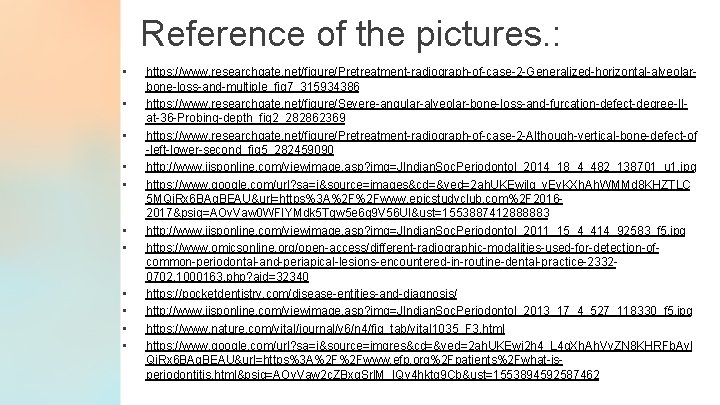 Periodontal Disease Horizontal and vertical bone loss localized