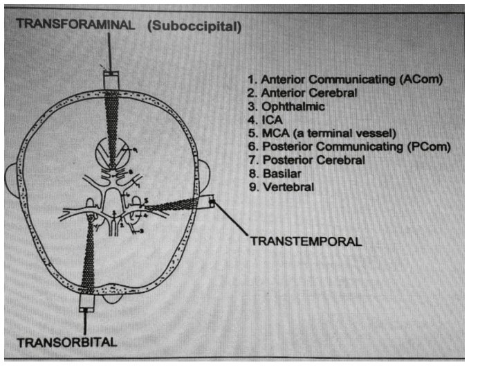 Diagnostic Medical Sonography Program Lecture 20 Transcranial Doppler