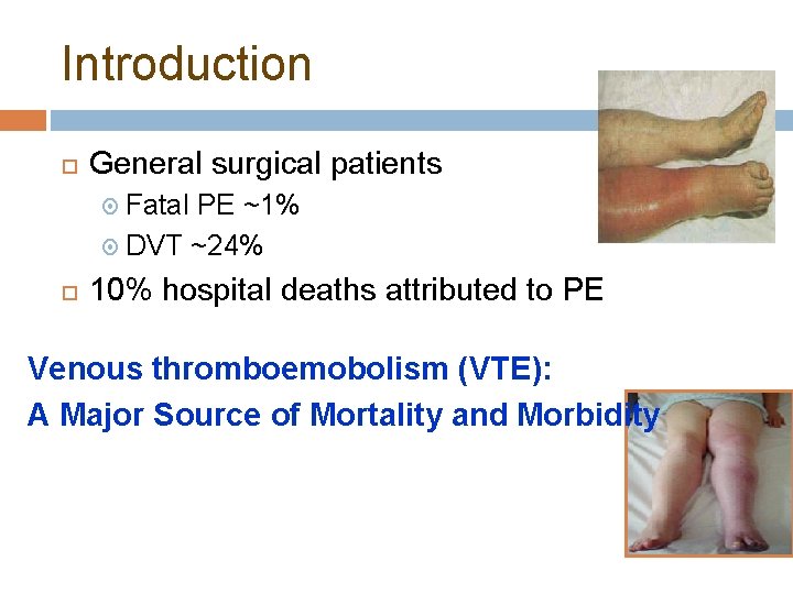 Deep Vein Thrombosis and Pulmonary Embolism prophylaxis in