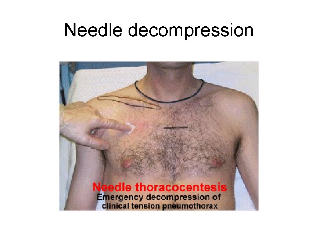 Management of Surgical Emergencies Part 1 Critical Care