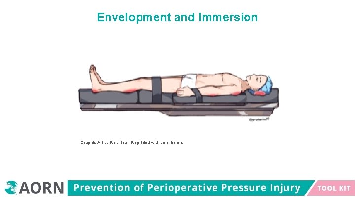 Prevent Perioperative Pressure Injury What is a Pressure