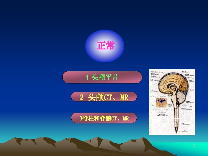 Brain and spinal cord Normal Appearance of Head
