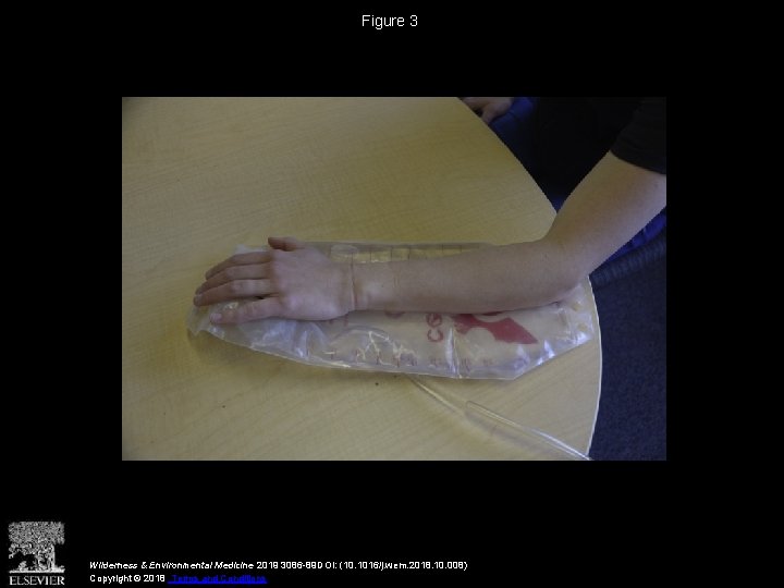 Improvised Hydration Bladder Air Splint A Wilderness Case