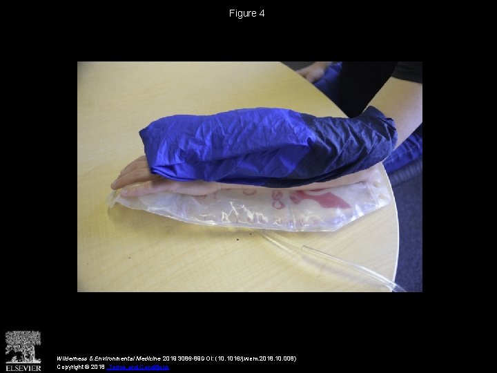 Improvised Hydration Bladder Air Splint A Wilderness Case