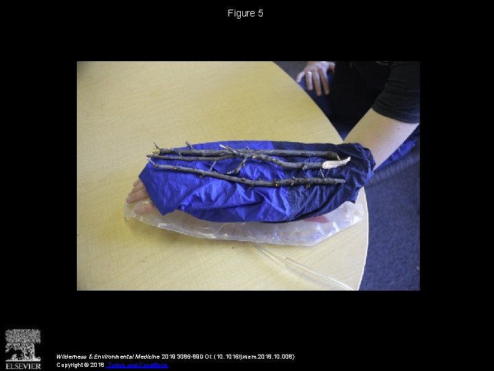 Improvised Hydration Bladder Air Splint A Wilderness Case