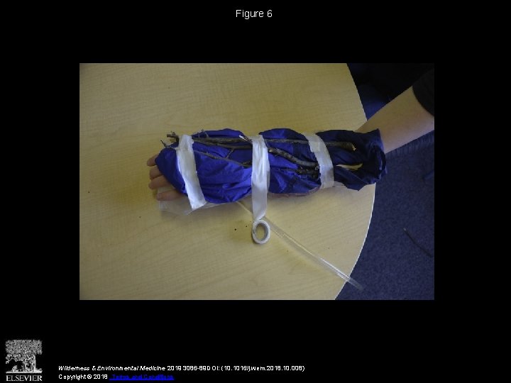 Improvised Hydration Bladder Air Splint A Wilderness Case