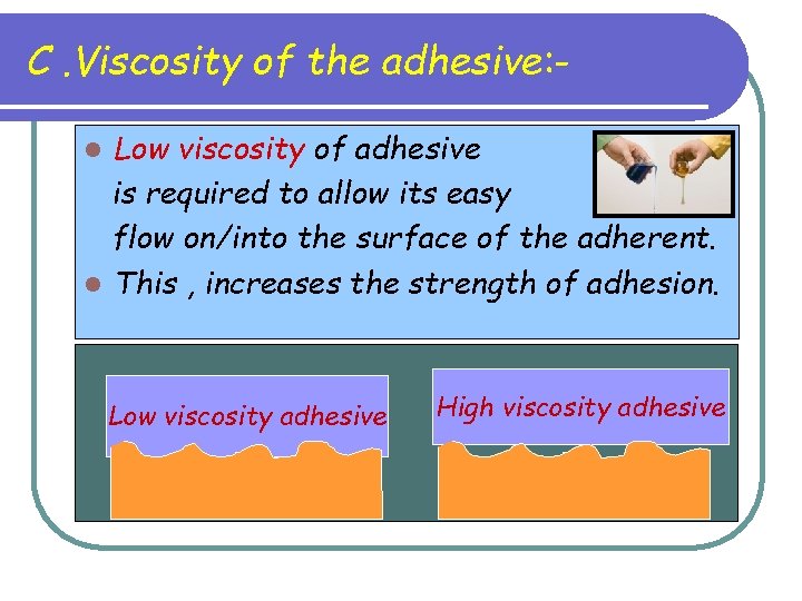 Adhesion by Prof Sayed Saniour Chairman of Dental