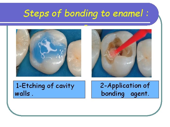 Adhesion by Prof Sayed Saniour Chairman of Dental