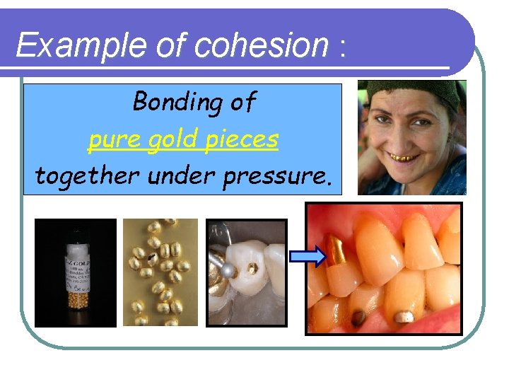 Adhesion by Prof Sayed Saniour Chairman of Dental
