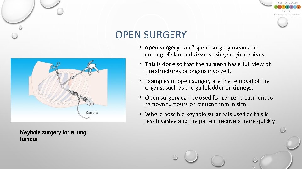 UNDERSTANDING CANCER PART 3 CANCER TREATMENT HOW SURGERY