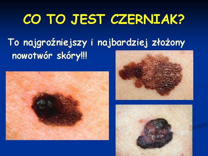 CO TO JEST CZERNIAK To najgroniejszy i najbardziej