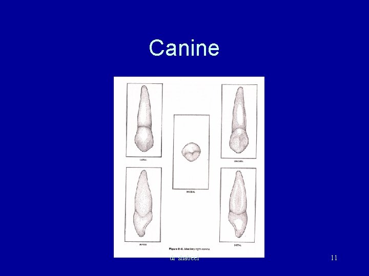 Dental Anatomy dr shabeel 1 Nomenclature Maxilla Mandible