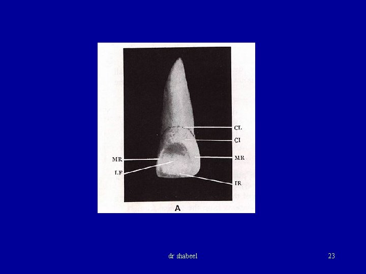 Dental Anatomy dr shabeel 1 Nomenclature Maxilla Mandible