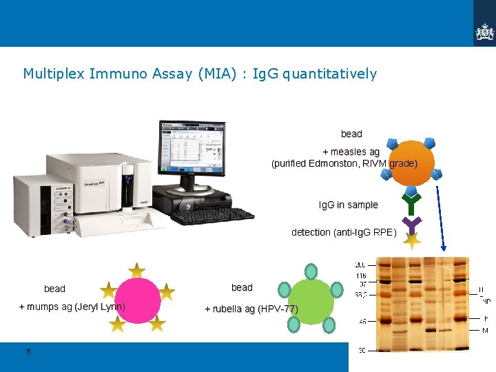 Multiplex immunoassay MIA based on x MAP Luminex
