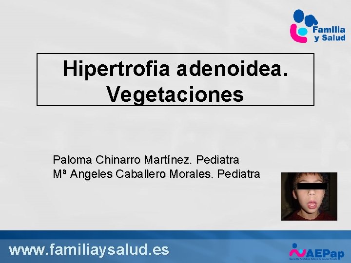 Hipertrofia adenoidea Vegetaciones Paloma Chinarro Martnez Pediatra M