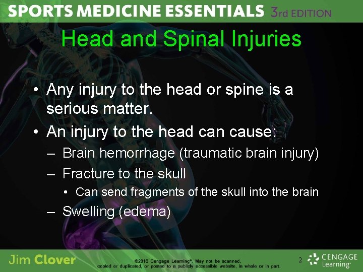 Chapter 12 Injuries to the Head and Spine