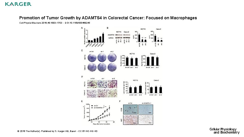 Promotion of Tumor Growth by ADAMTS 4 in