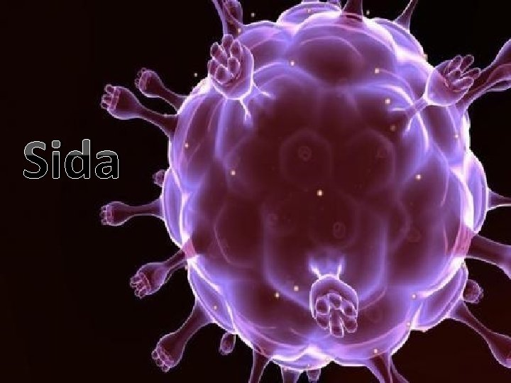 Sida Que es el sida La enfermedad de