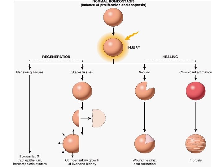 PATHOLOGY WOUND HEALINGREGENERATION AND REPAIR Repair Regeneration Repair