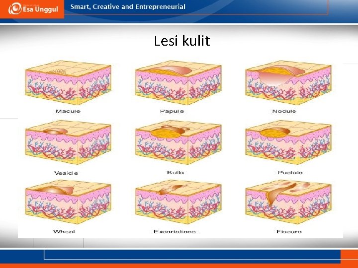 patofisiologi pada sistem integumen skin dan jaringan subcutaneus