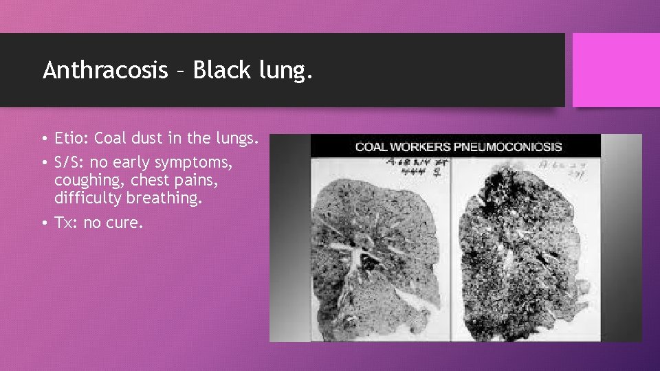Respiratory Health Concerns Asthma bronchial airway obstruction Etio