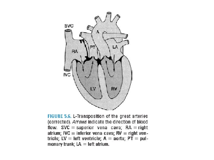 Lecture 56 Development of Heart II Learning Objectives