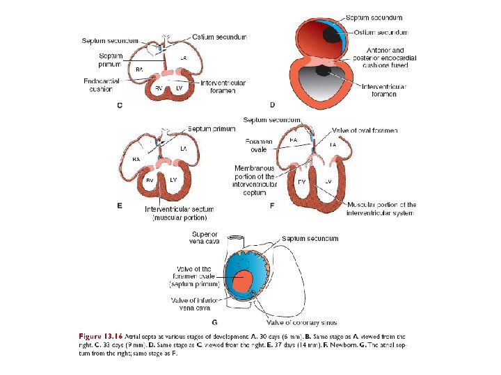 Lecture 56 Development of Heart II Learning Objectives