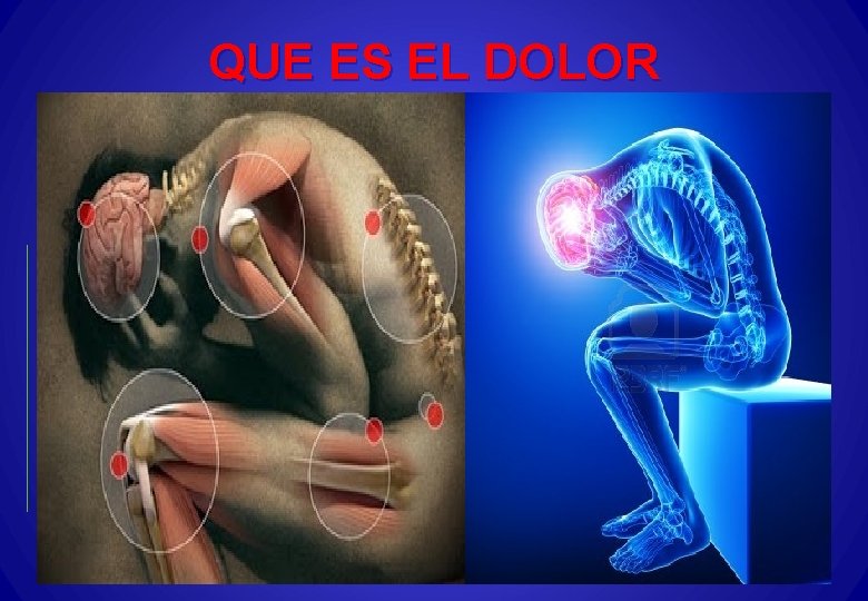 EL DOLOR EL SISTEMA NERVIOSO El sistema nervioso