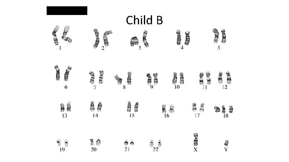 Genetic Tools Genetic Tools Pedigree Karyotype DNA Fingerprinting