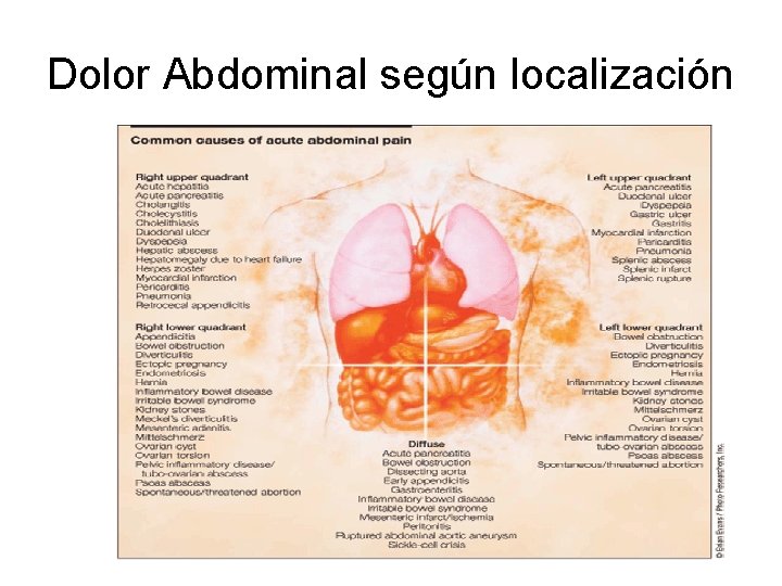 Abdomen Agudo Dr Andrs Volio C Residente de