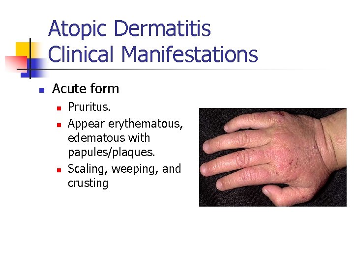 Dermatology Maculopapular and Plaque Dermatitis By Stacey SingerLeshinsky