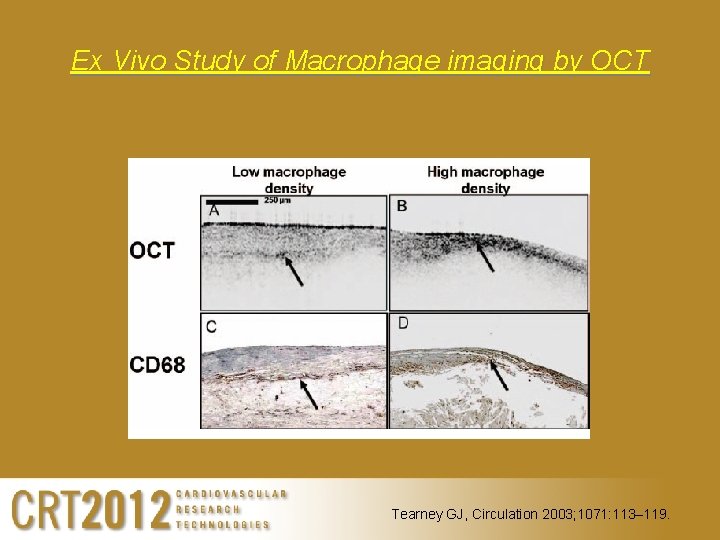 Use of OCT to Localize Subcellular Structures of