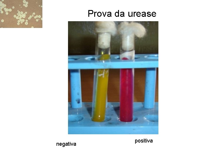 Micologia leveduras patognicas Candida spp e Cryptococcus neoformans