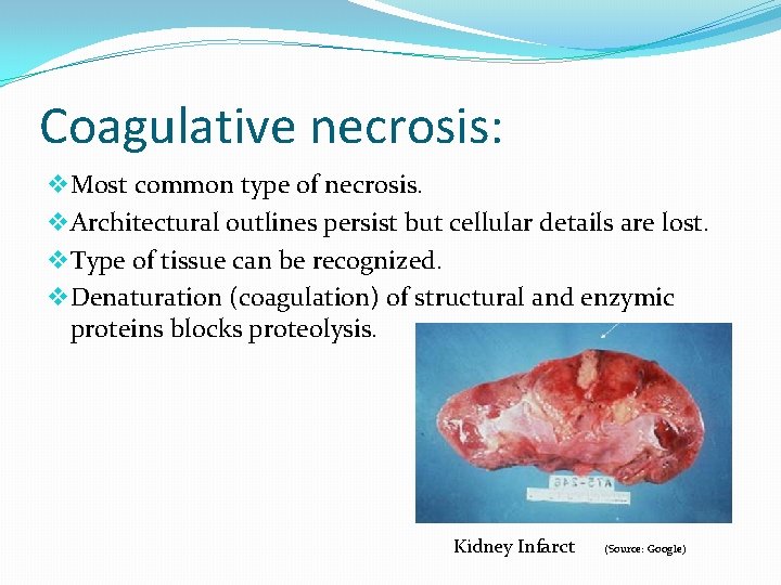Necrosis Its Classification Subject Veterinary Pathology PaperI Unit