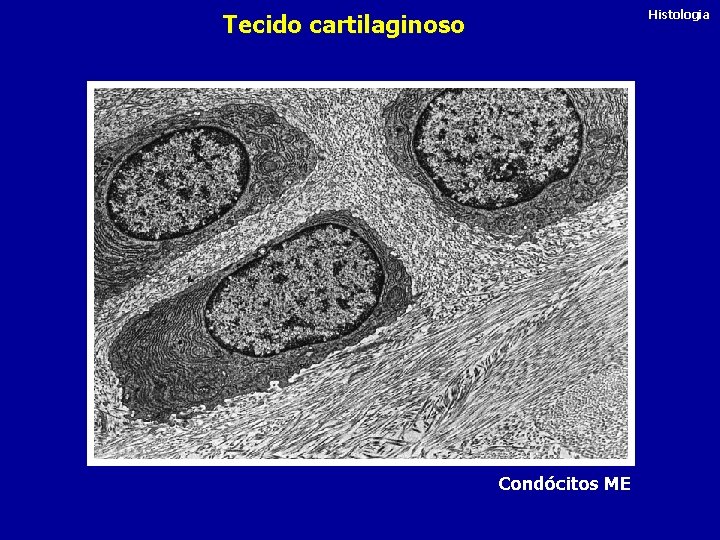 Histologia Tecido cartilaginoso cartilagens Suporte para tecidos moles