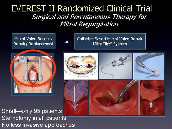 Debate EVEREST and Residual Mitral Regurgitation Percutaneous Mitral