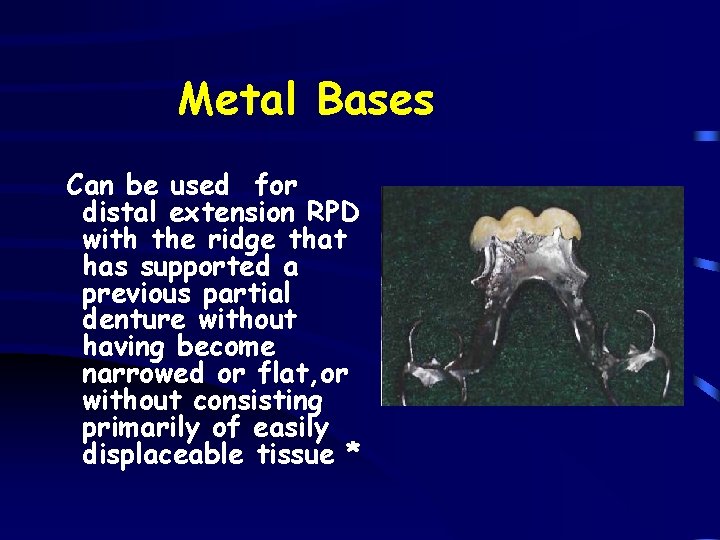 Denture Bases Replacement Denture Teeth Rola M Shadid