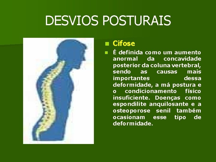 DESVIOS POSTURAIS Uma boa postura a atitude que