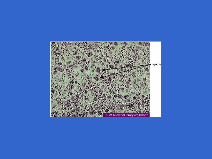 Viral Identification Detection by CPE Detection Of Viral
