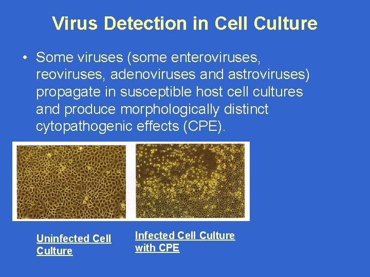 Viral Identification Detection by CPE Detection Of Viral