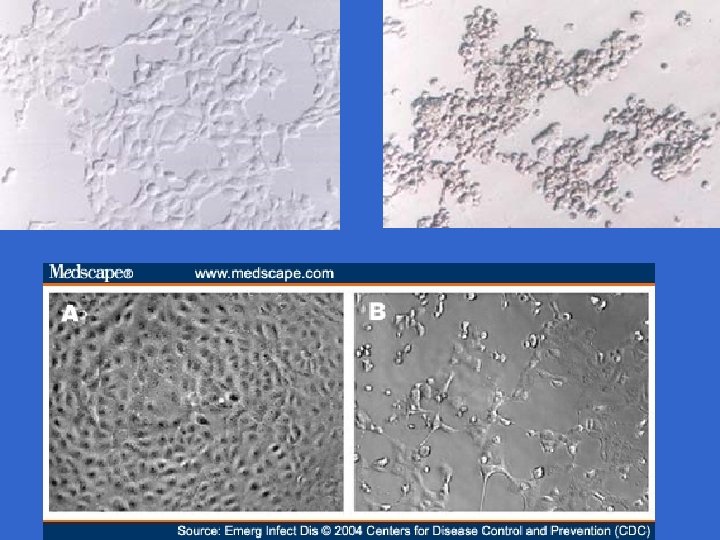 Viral Identification Detection by CPE Detection Of Viral