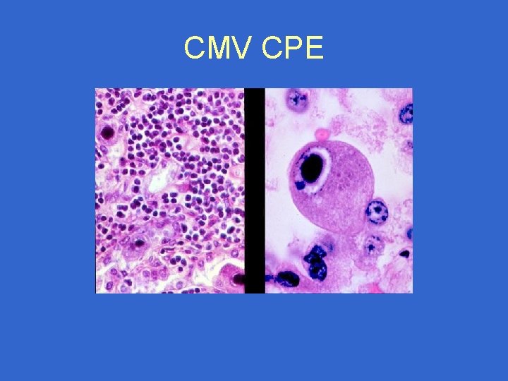 Viral Identification Detection by CPE Detection Of Viral