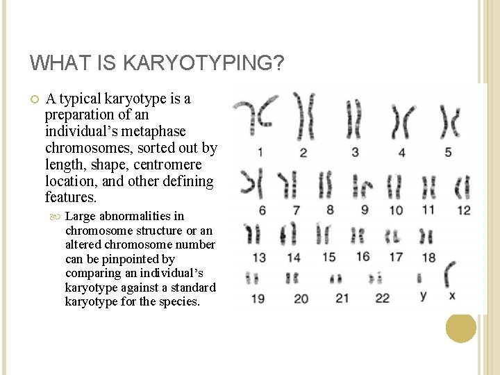 THE HUMAN CHROMOSOME WHAT IS KARYOTYPING A typical